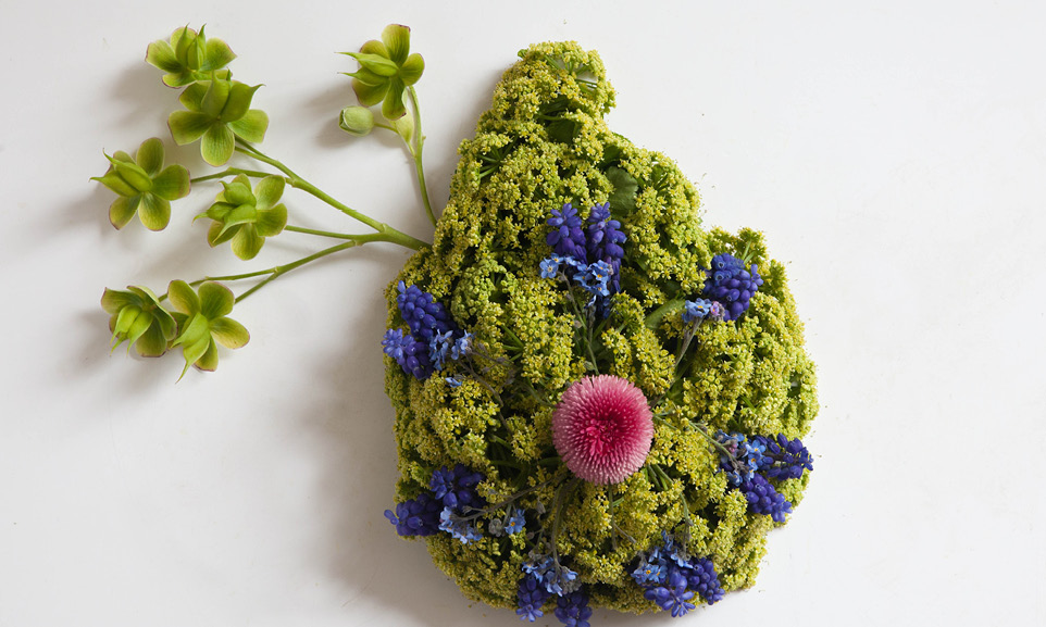 Alloimmune Thrombocytopaenic Disorders: A Review - European Medical Journal