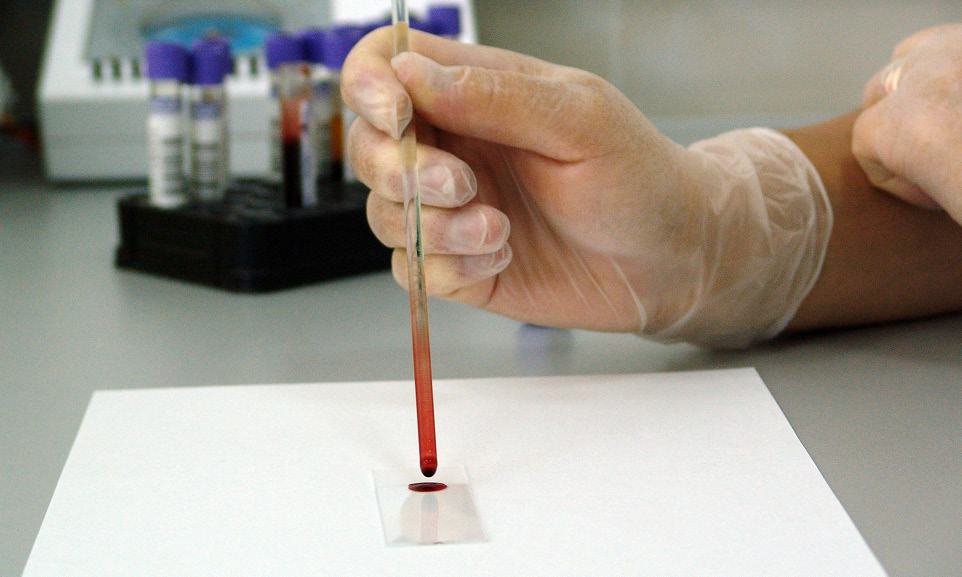 Conversion Technique Could Enhance Understanding of Neurological ...