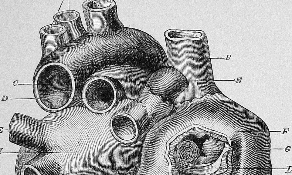 History of Interventional Cardiology - European Medical Journal