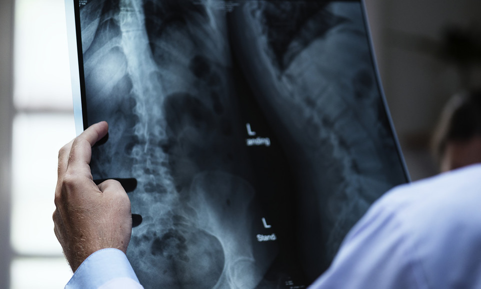 Routine Lung Check Enables Early Detection of Lung Cancer - European ...