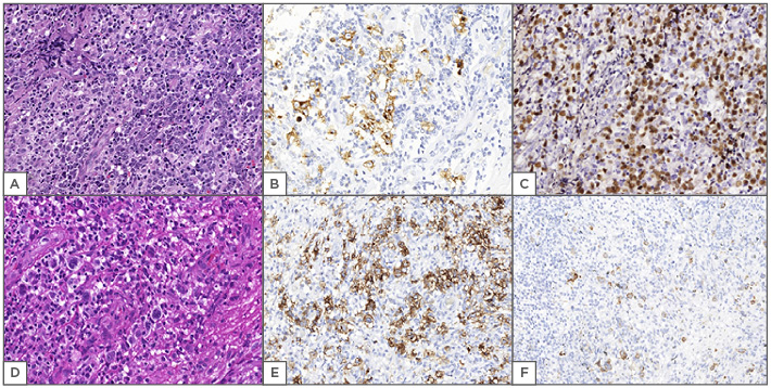 Epstein–Barr Virus: A Biological Overview and Clinicopathological ...