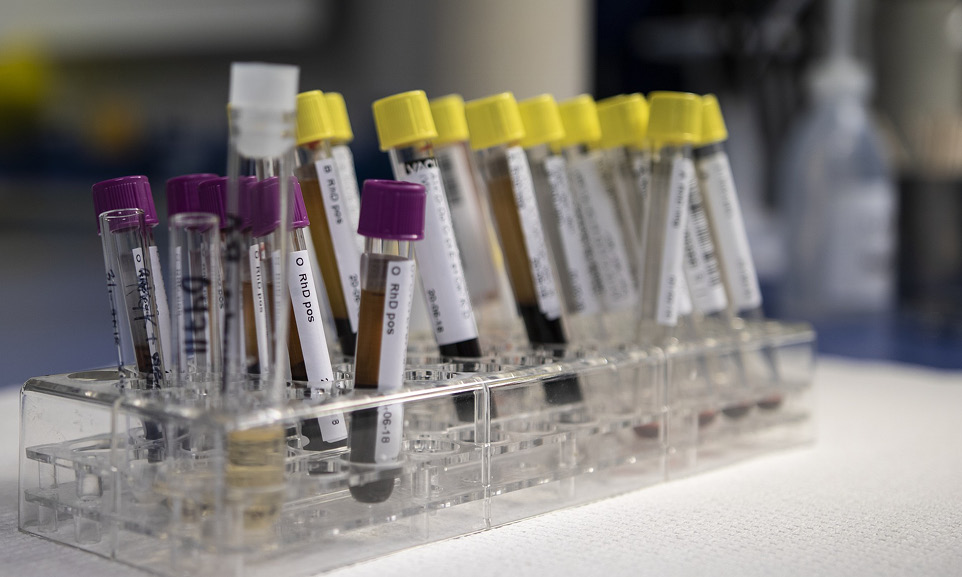 Universal Blood Test for Cancer Under Development - European Medical ...