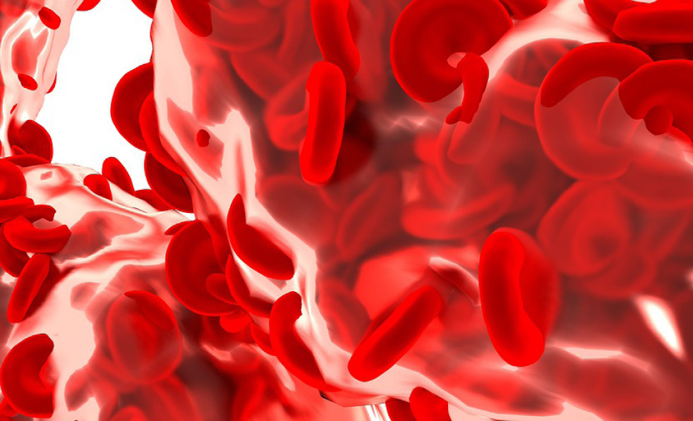 Novel, Bone-Like Particles in Bone Marrow Blood Vessels - EMG