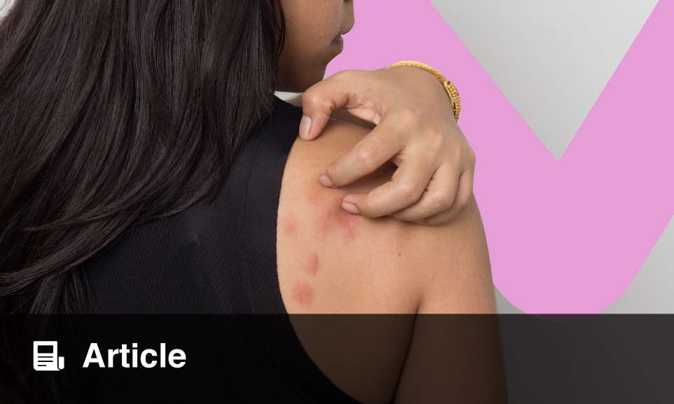 Editor's Pick: Chronic Spontaneous Urticaria: A Review of Pathological ...