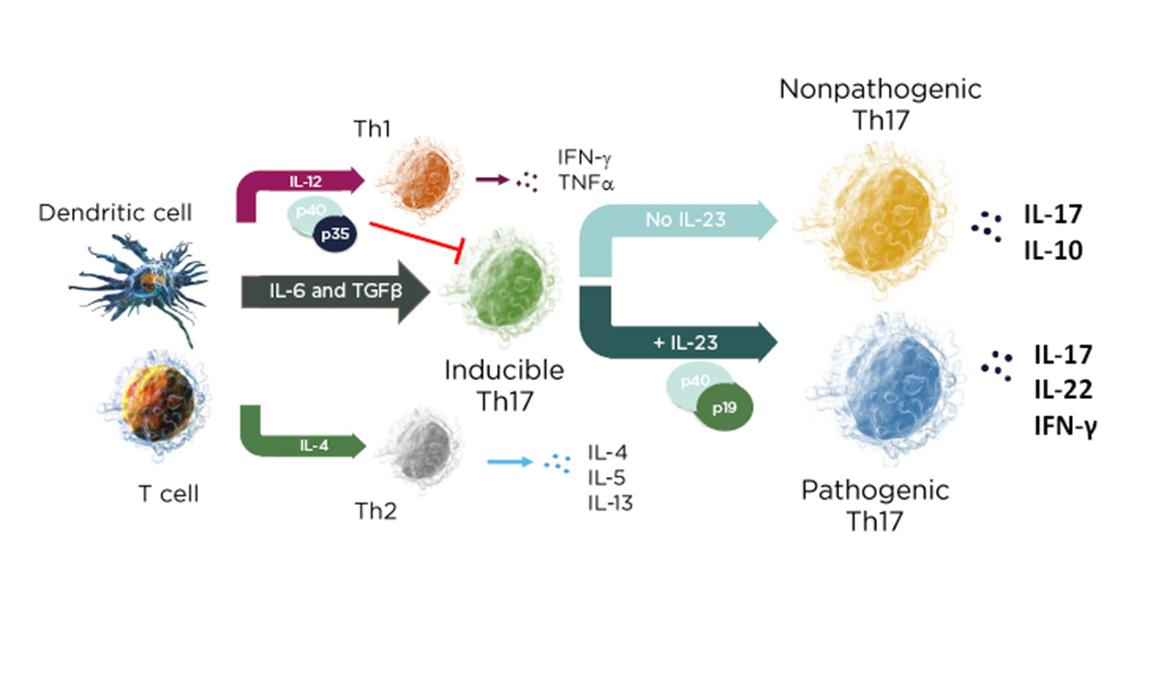 Psoriatic Arthritis Infographic