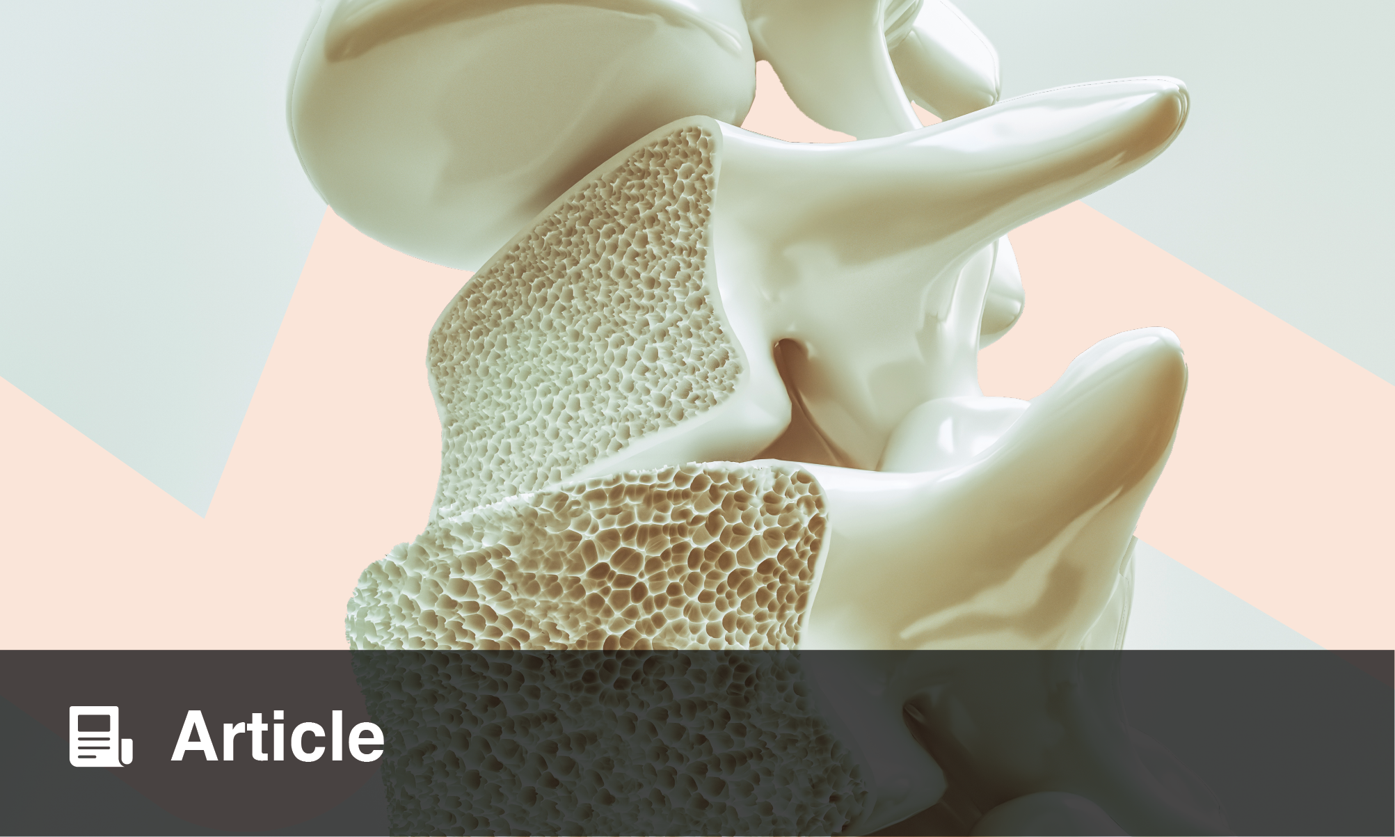 Bone Health in Rheumatoid Arthritis: What Can Studies of Bone ...