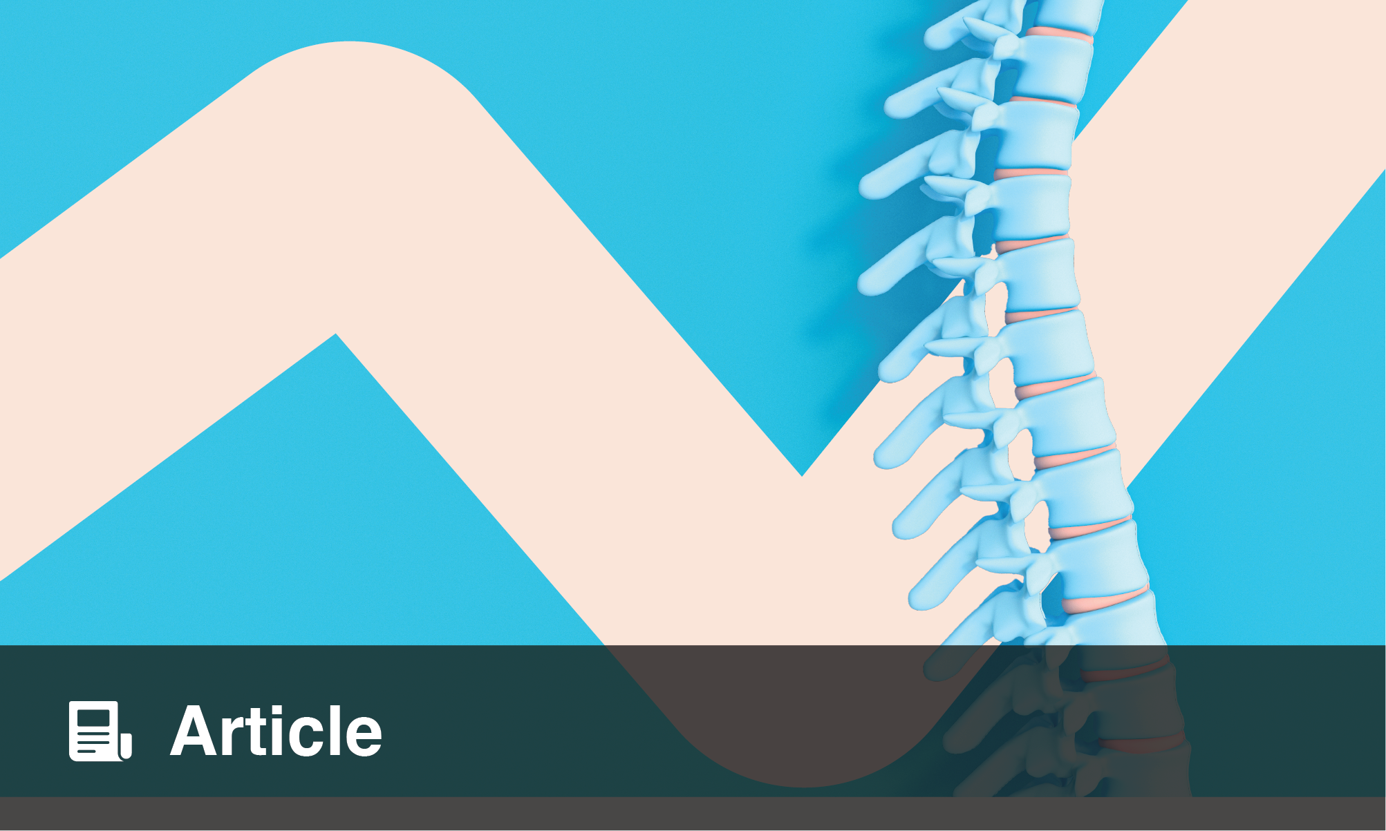 Early Recognition and Treatment of Spondyloarthritis: A Timeless ...