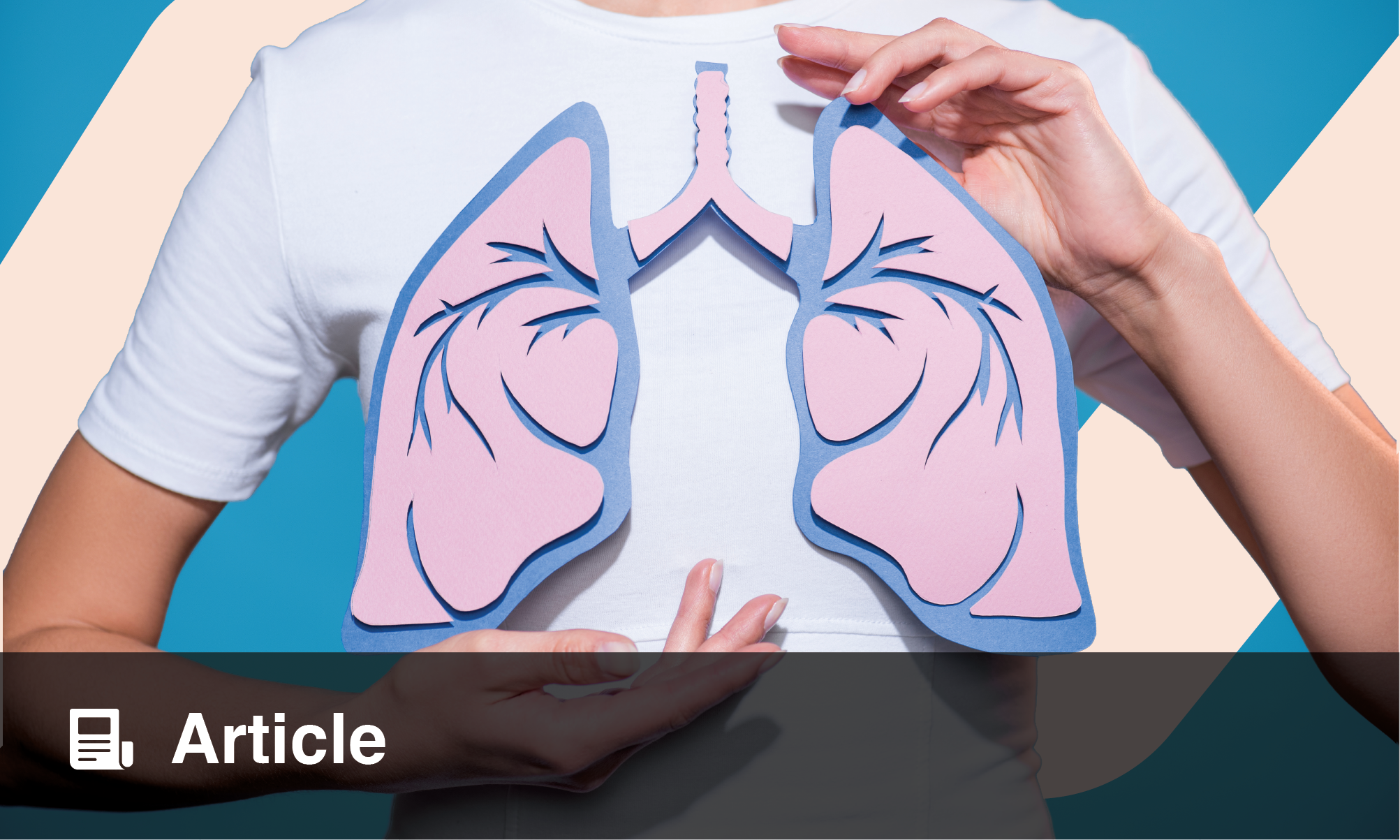 Editor’s Pick: Methotrexate and The Lung in Rheumatoid Arthritis | EMJ