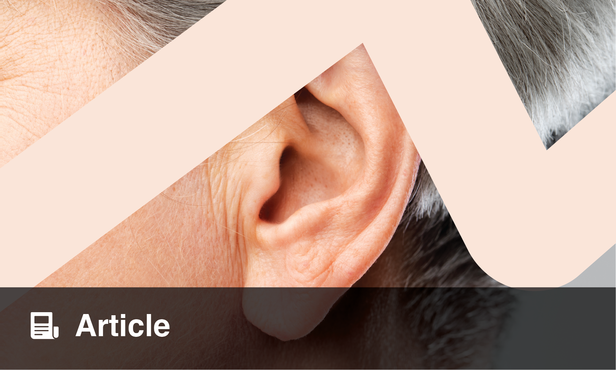 Using Audiometry to Track Atherosclerosis: Measuring a Beneficial ...