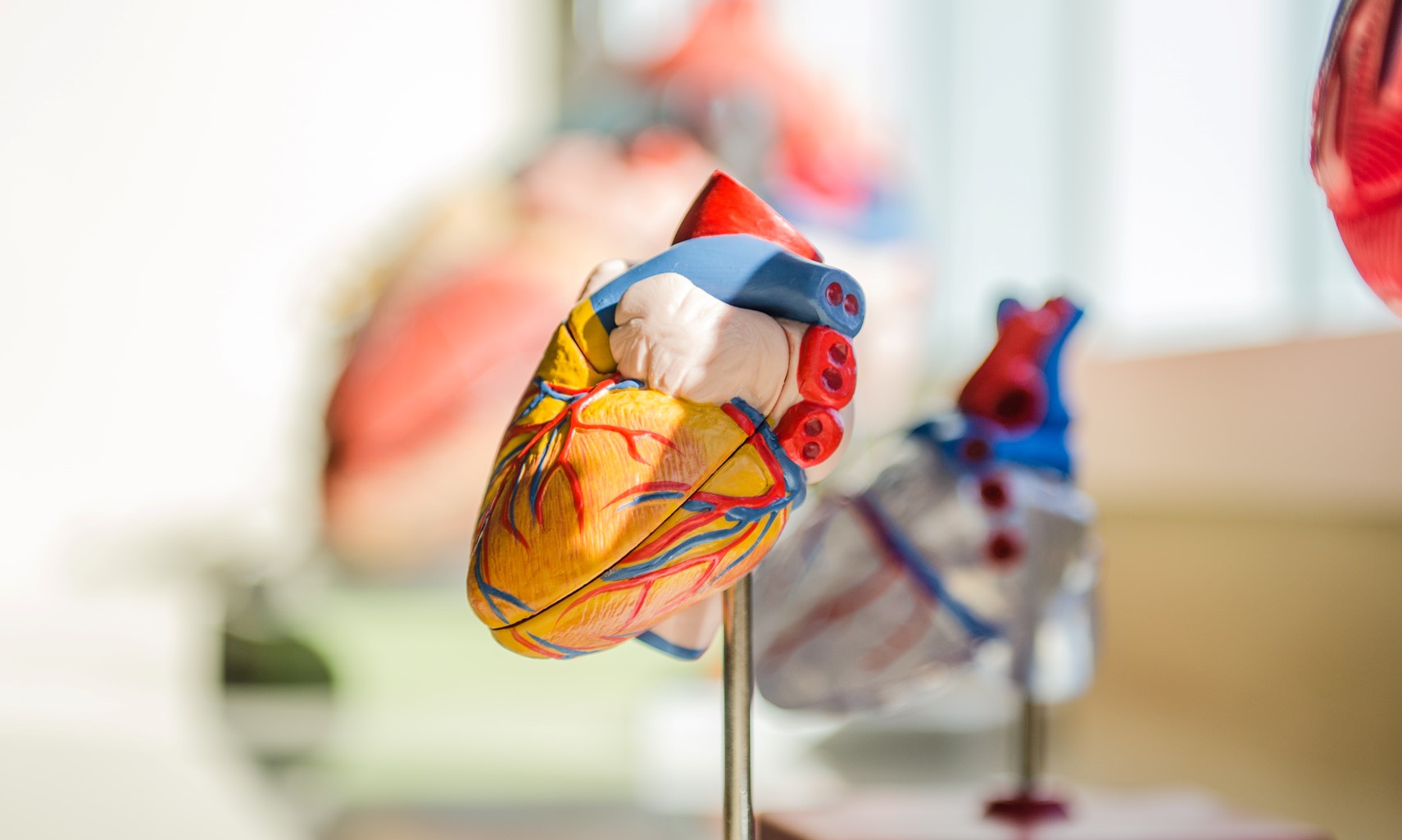 Management of Atrial Fibrillation (AF) with ACS and/or Undergoing PCI ...