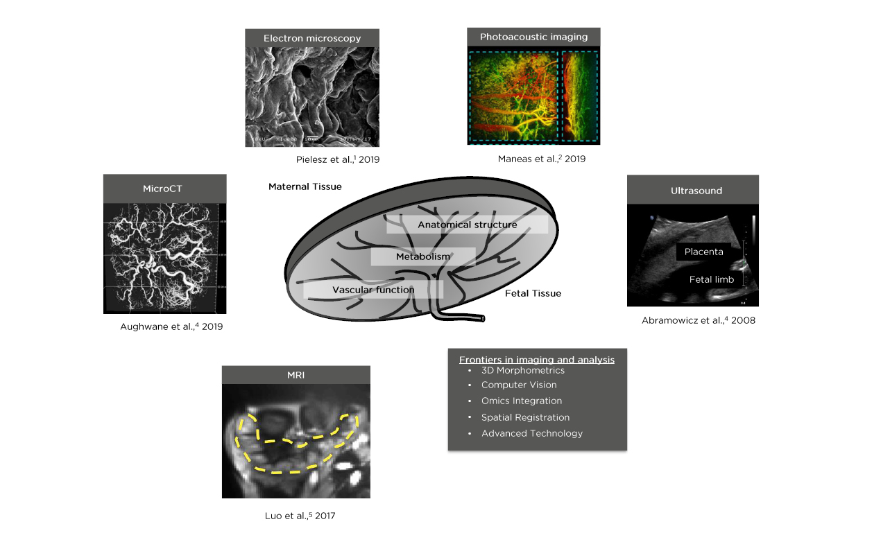 New Frontiers in Placenta Tissue Imaging - European Medical Journal