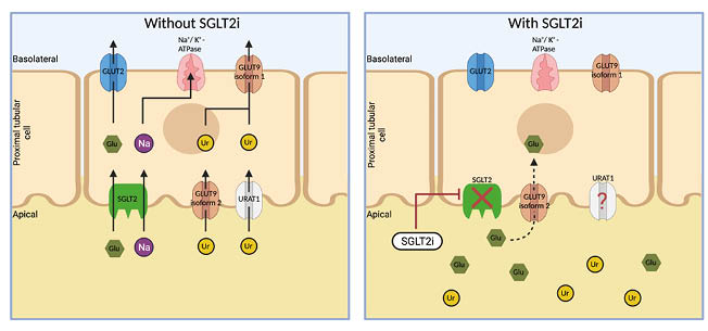 Editor’s Pick: The Renal Effects of SGLT2 Inhibitors - European Medical ...