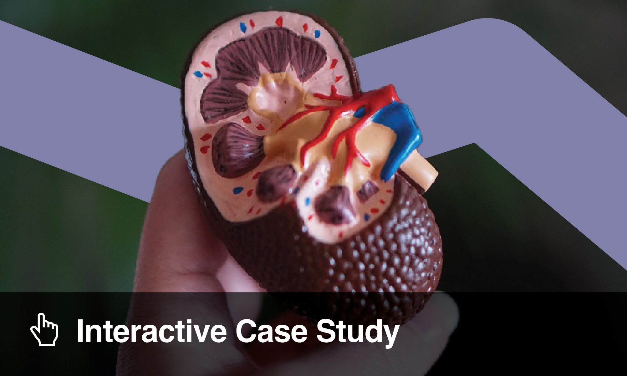 Ensuring a Treatment Continuum for Chronic Kidney Disease-Mineral and ...