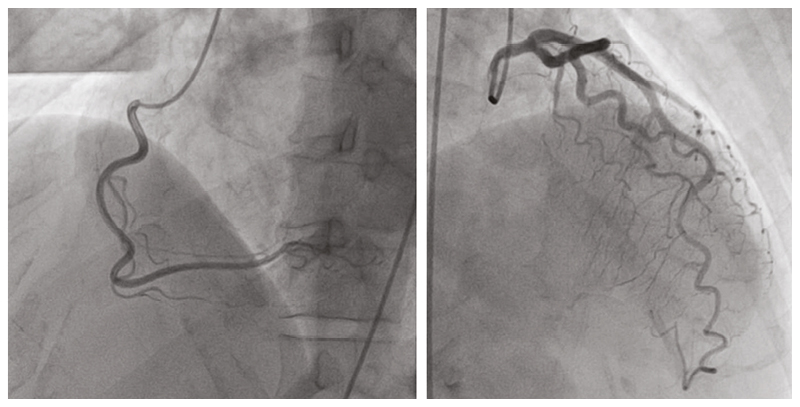Editor’s Pick: Obstructive Sleep Apnoea as an Exacerbator of ...