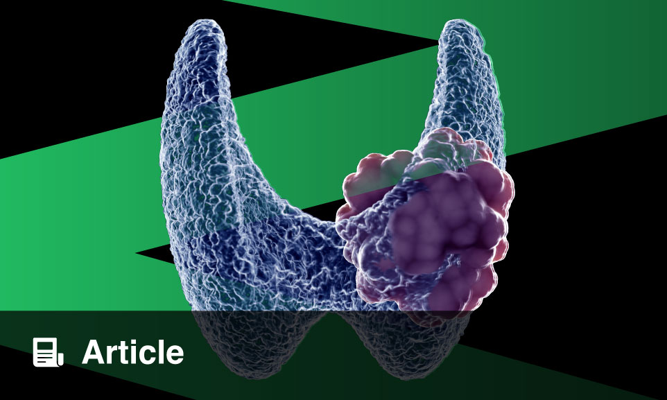 Thymoma-Associated Good Syndrome: A Case Report and Literature Review ...