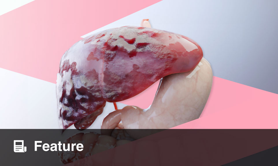 Prevention of Decompensation in Compensated Cirrhosis: Non-Selective ...