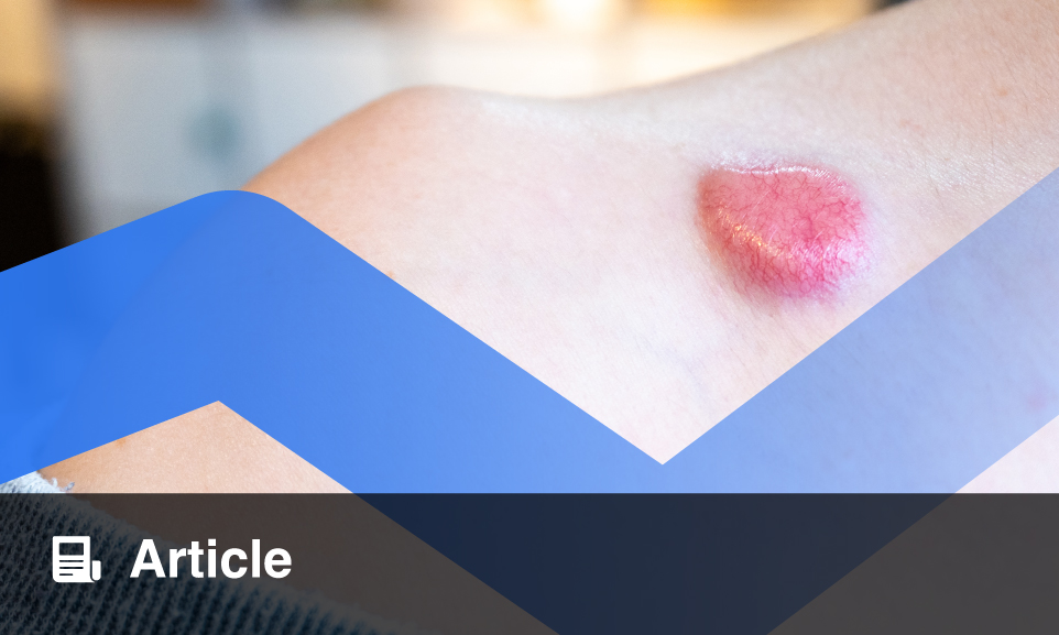 Congenital Dermatofibrosarcoma Presenting as an Atrophic Plaque ...