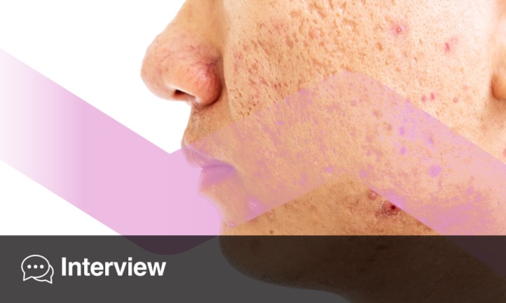 Skin Microbiome and Acne: Microbial Imbalances and Impact - European ...