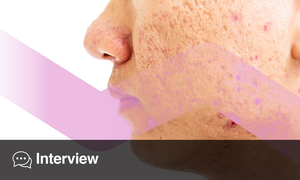 Skin Microbiome and Acne: Microbial Imbalances and Impact – Interview ...