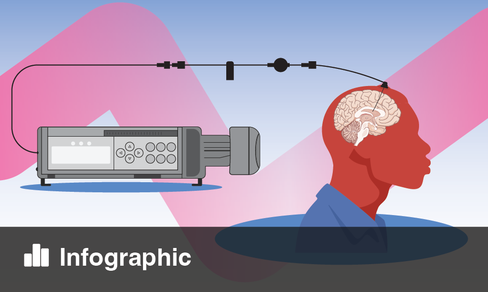 Long-Term Data For Cerliponase Alfa (Brineura) In Children With CLN2 ...