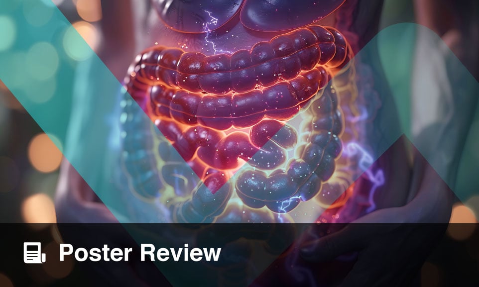 Retracted: Ozanimod in Ulcerative Colitis: Key New Data - European ...