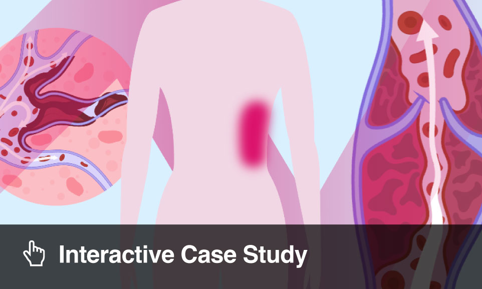 Case Report of a Patient Presenting with Acute Flank Pain - European ...