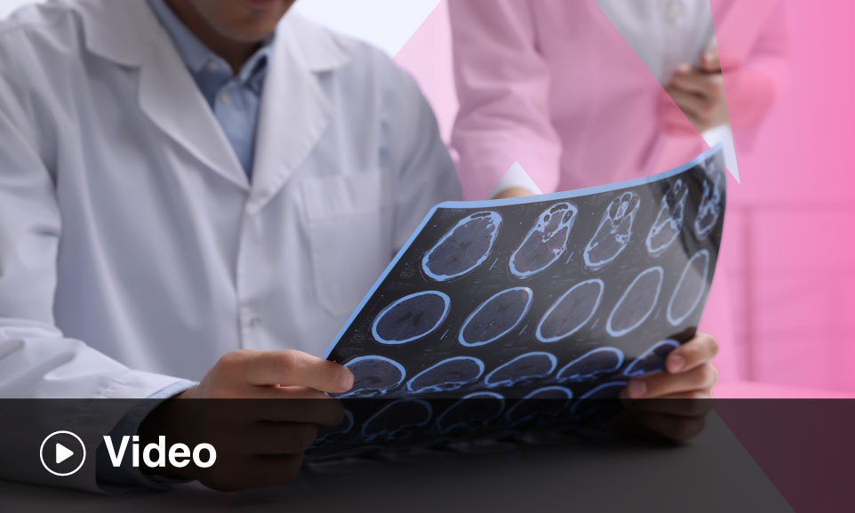 Transforming MS Care: Early Intervention and Sustained Safety ...