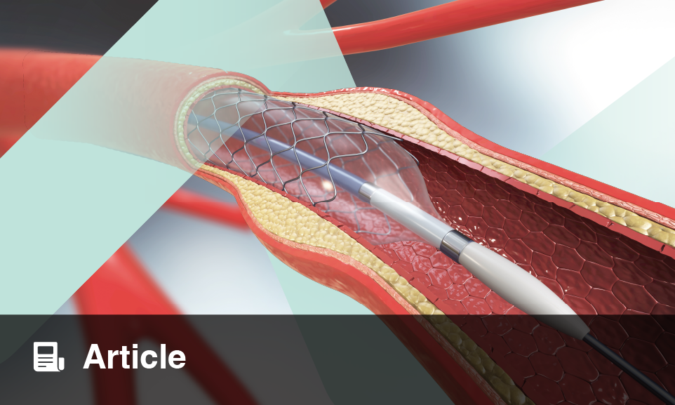 Drug-Coated Balloons in Percutaneous Coronary Interventions: Insights ...