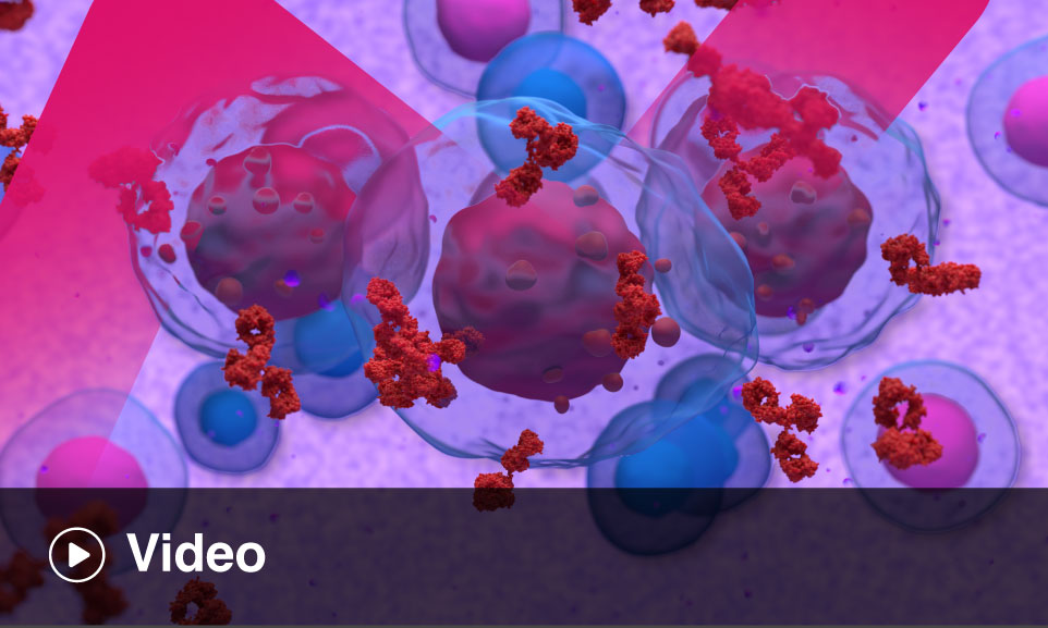 Infection Risk in Focus: How Do Haematologic Malignancies and ...