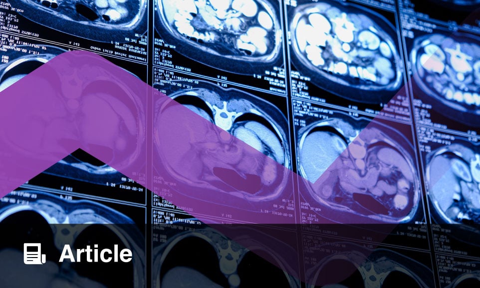 Travelling from the Inferior Vena Cava to the Right Atrium Braving All ...