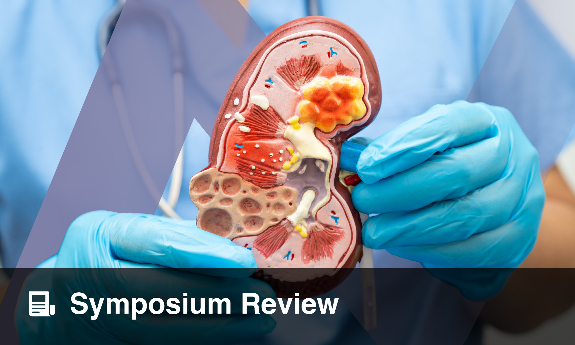 Revolutionising IgA Nephropathy Care in the Era of Precision Medicine ...