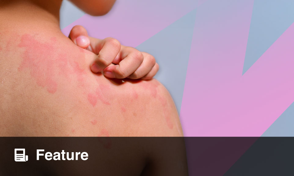 Clinical Perspectives on Photosensitivity and Photodiagnostics ...