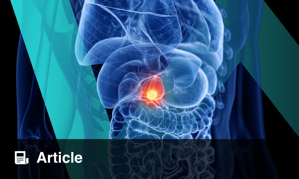Primary Squamous Cell Carcinoma of the Gallbladder with Hepatic ...