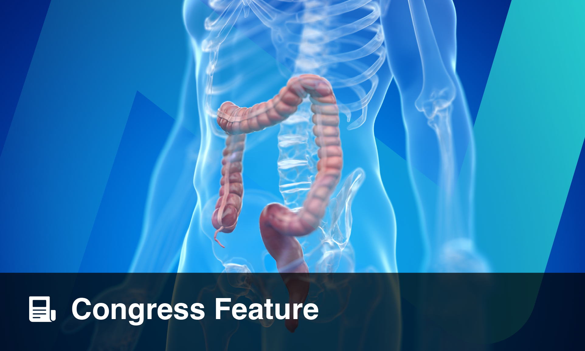 What’s New in Ulcerative Colitis? - European Medical Journal
