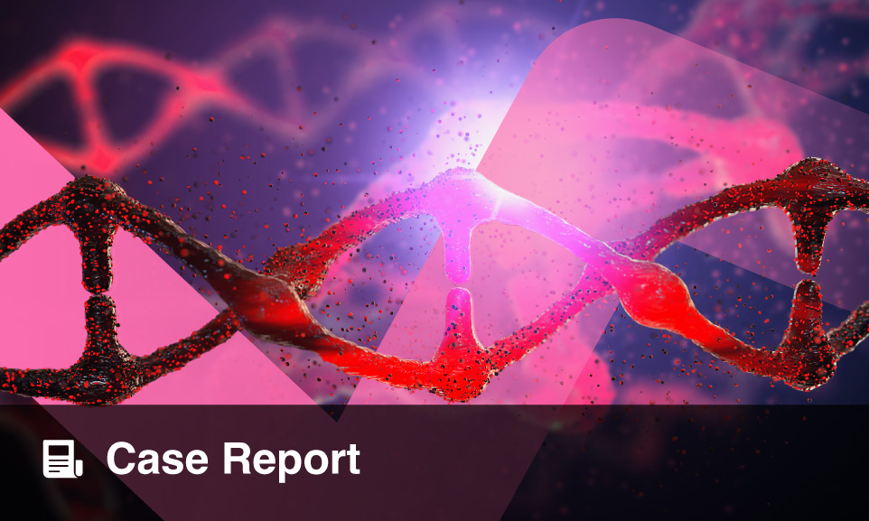 Myofibrillar Myopathy with a Novel LDB3 Variant (c.1804T>C) in a ...