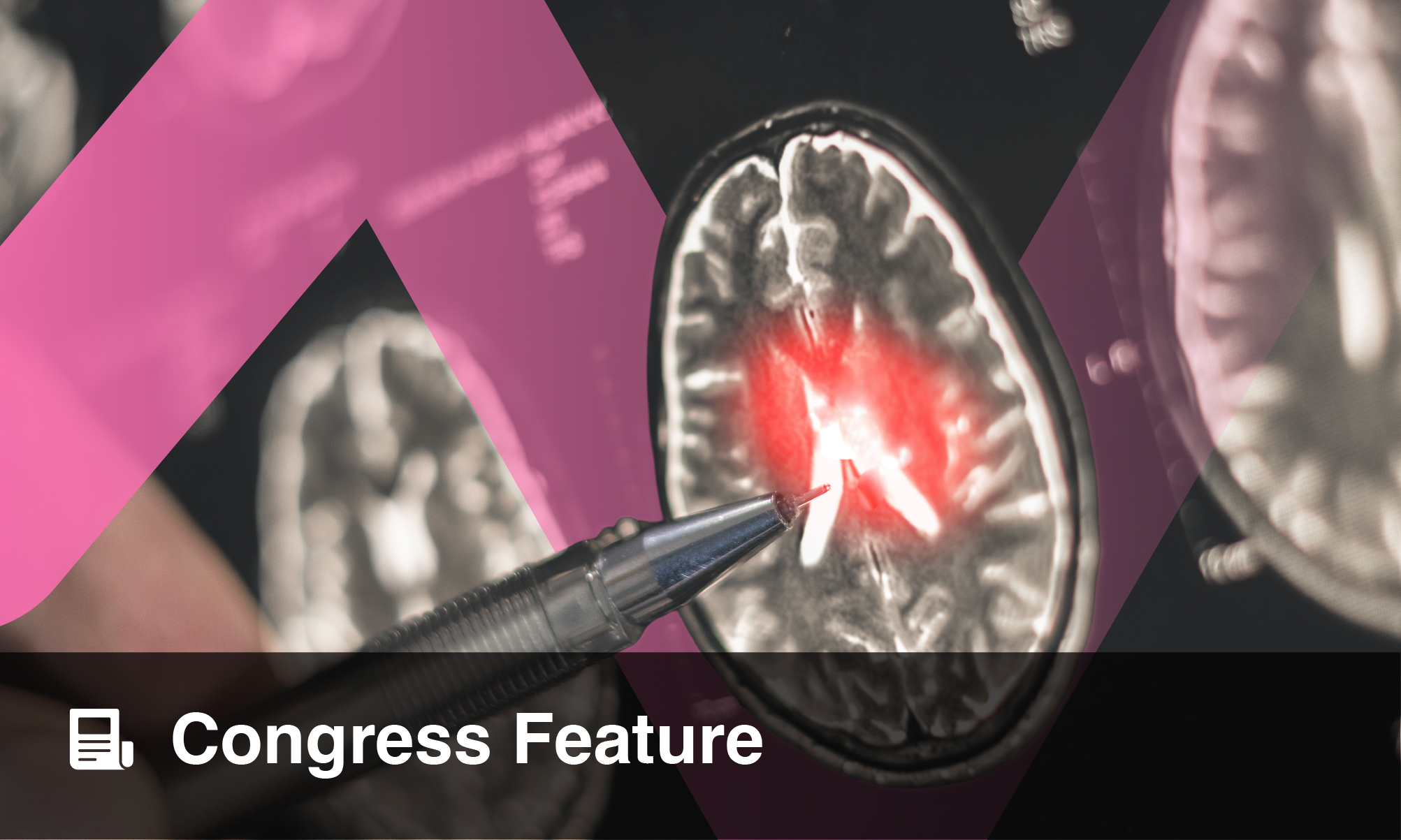 Updates in Multiple Sclerosis: AAN Annual Meeting 2026 - European ...